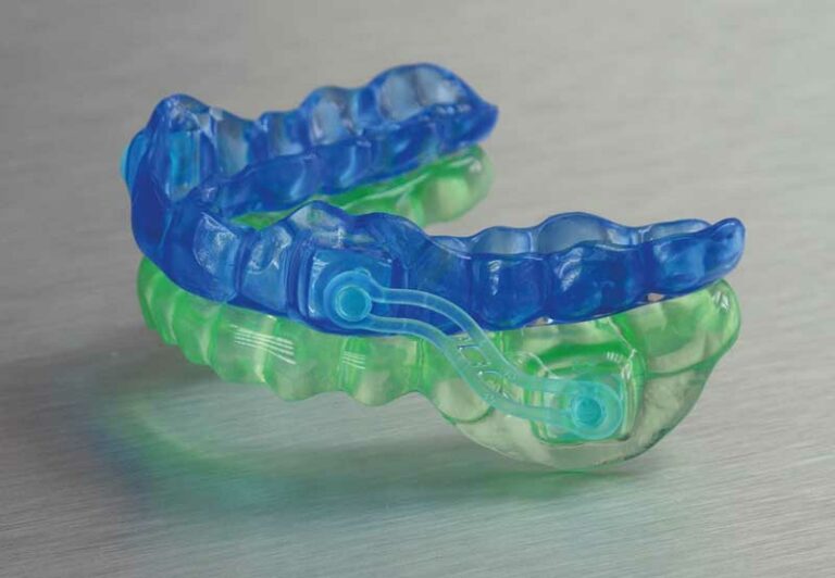 Schnarcher-Schiene - Zahnzentrum Stuttgart Mitte